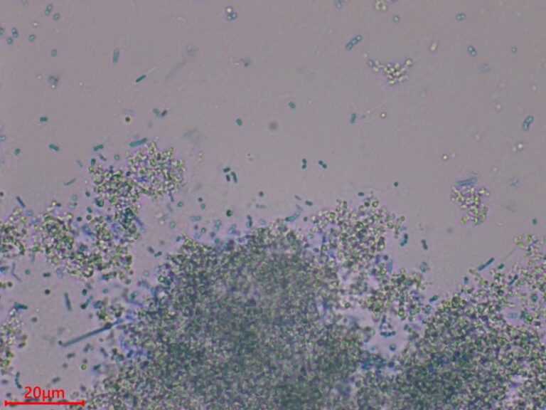 ヨーグルトの乳酸菌・ビフィズス菌を顕微鏡観察（3）ビヒダスヨーグルト編 | 顕微鏡ナビ